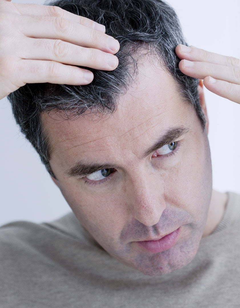 Understanding Hair Loss: Causes and Solutions – FOLIGAIN