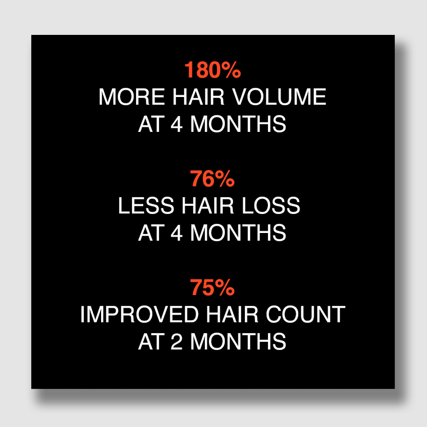 Trioxidil vs. Minoxidil: A Comprehensive Guide to Hair Regrowth Soluti ...